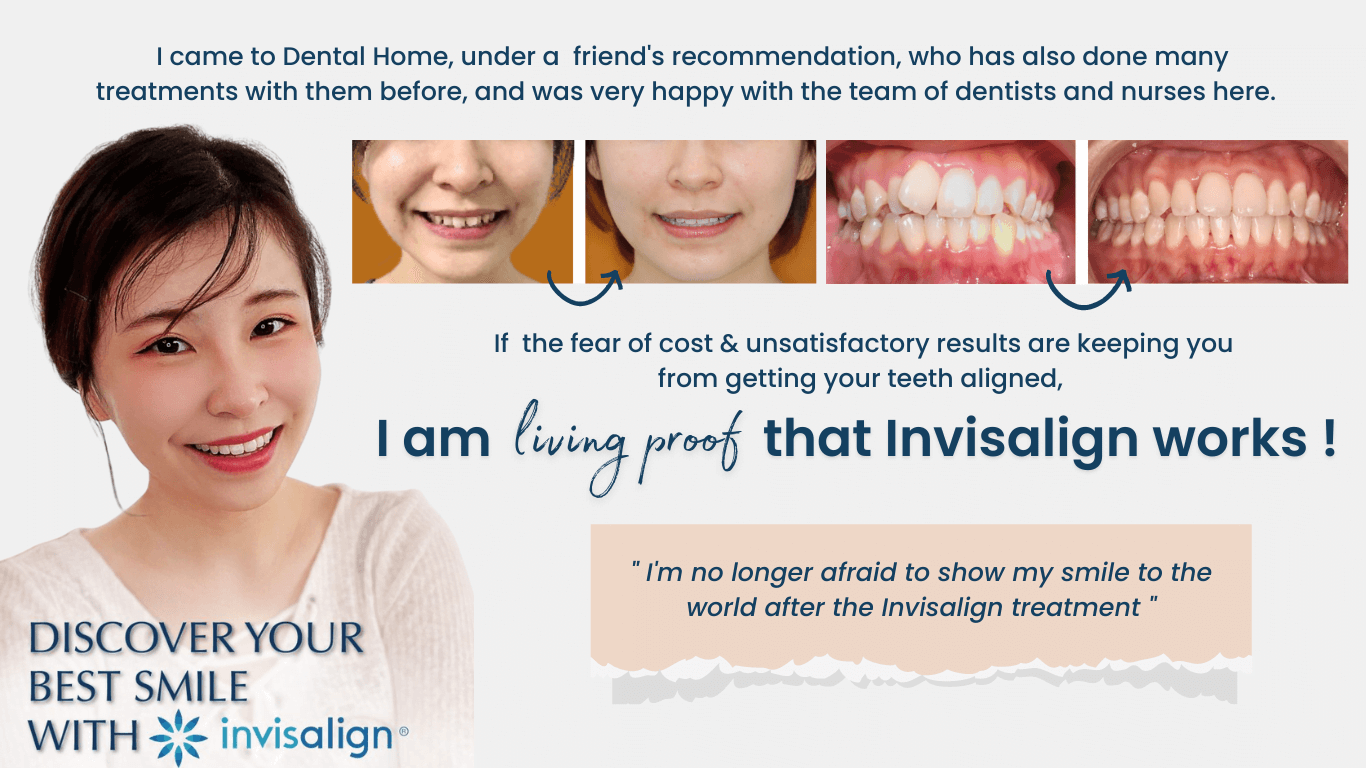 Invisalign Braces & Treatment in Kuala Lumpur, Malaysia - Dental Home
